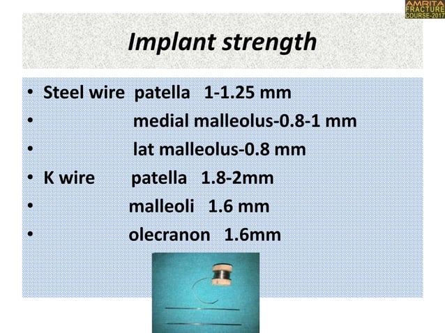 Tension band wiring and plating of fractures- dr mohamed ashraf.govt TD ...