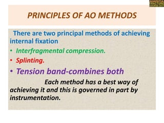 Tension band wiring and plating of fractures- dr mohamed ashraf.govt TD ...