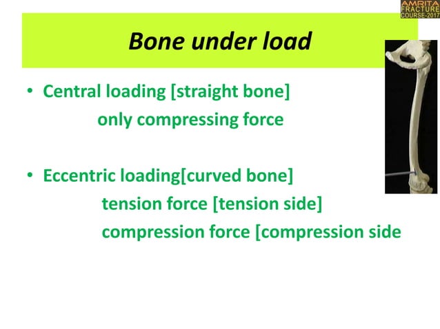 Tension band wiring and plating of fractures- dr mohamed ashraf.govt TD ...