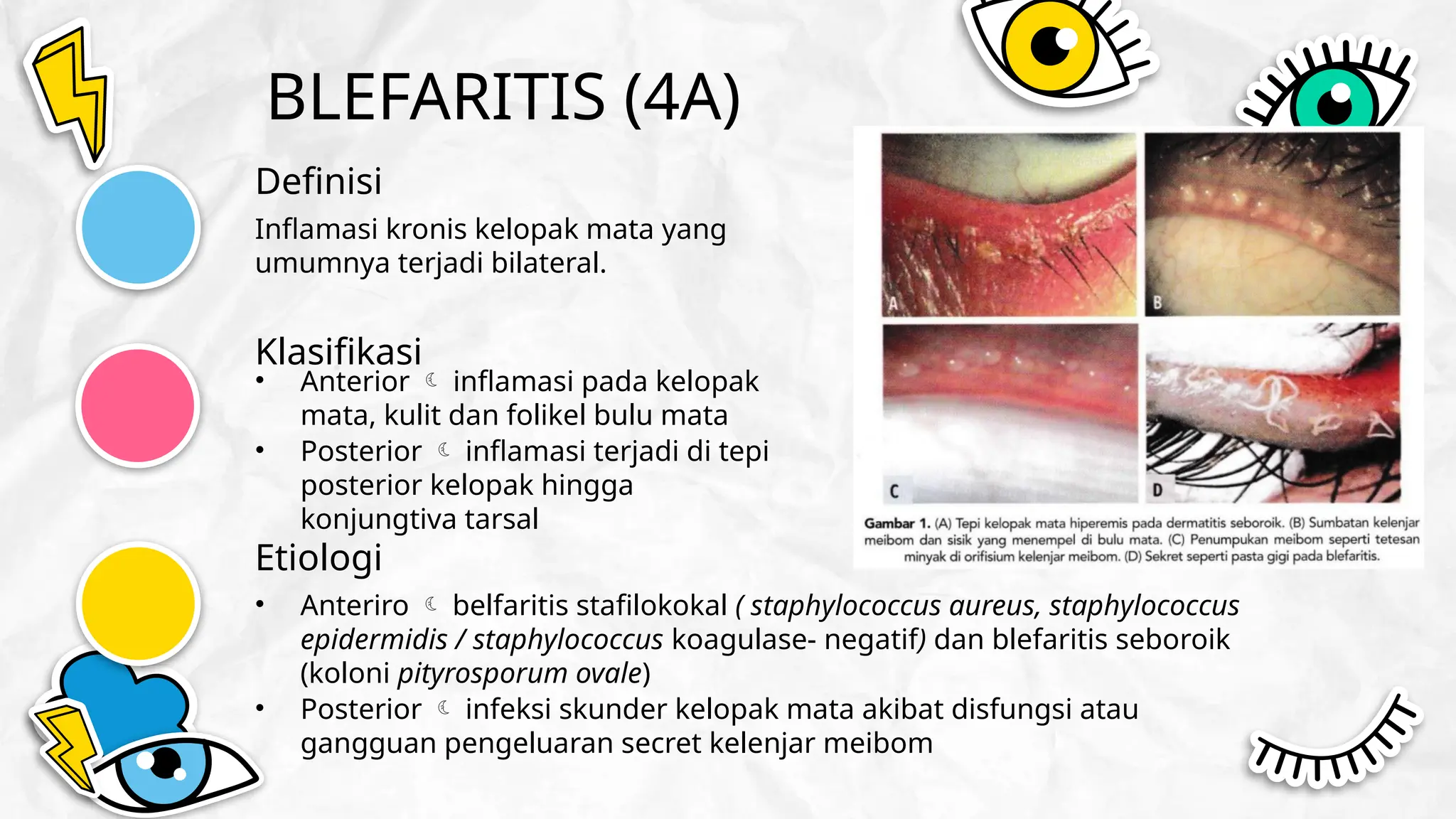 Tentiran PPT Anatomi dan Penyakit Palpebra.pptx