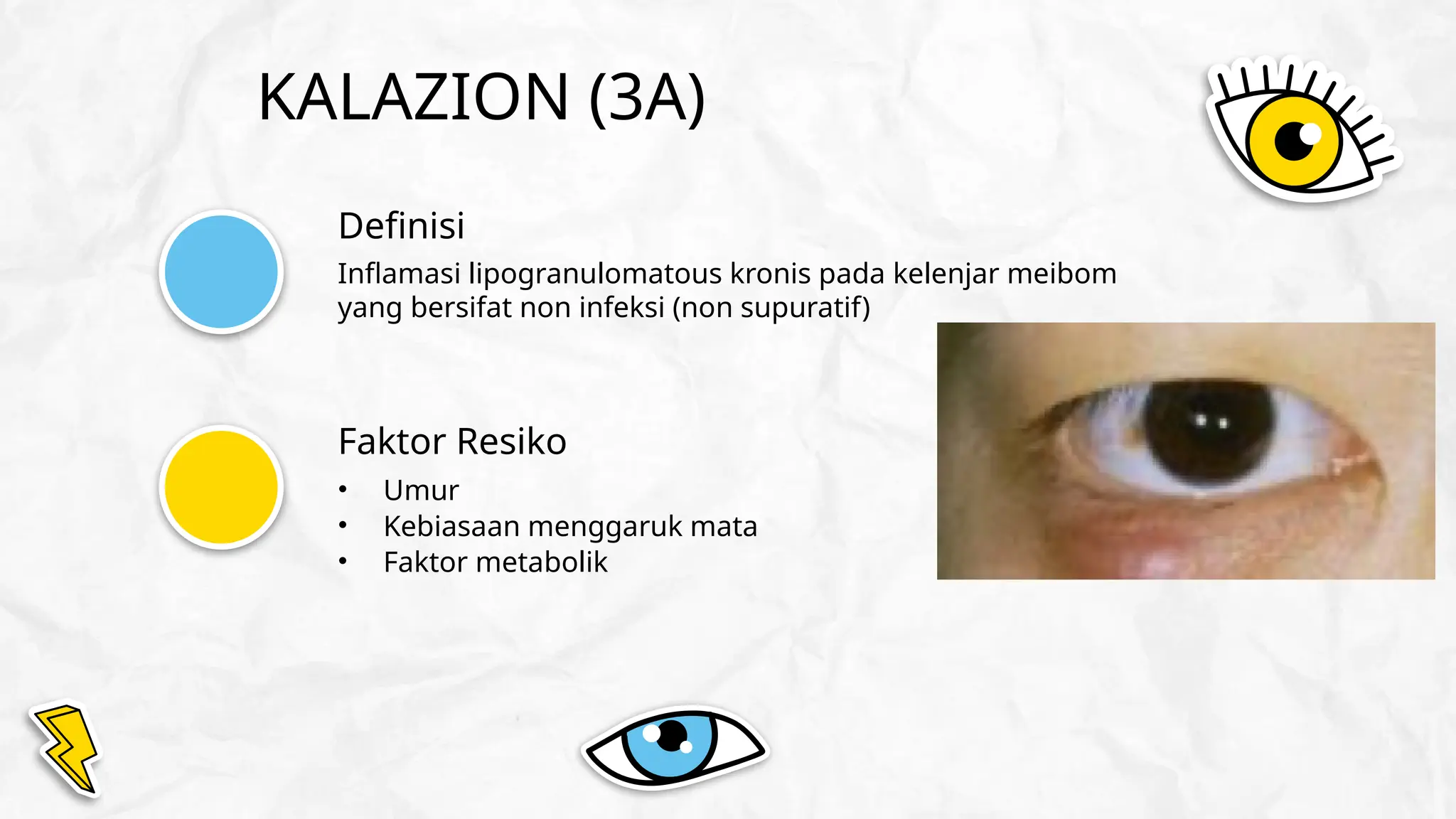Tentiran PPT Anatomi dan Penyakit Palpebra.pptx