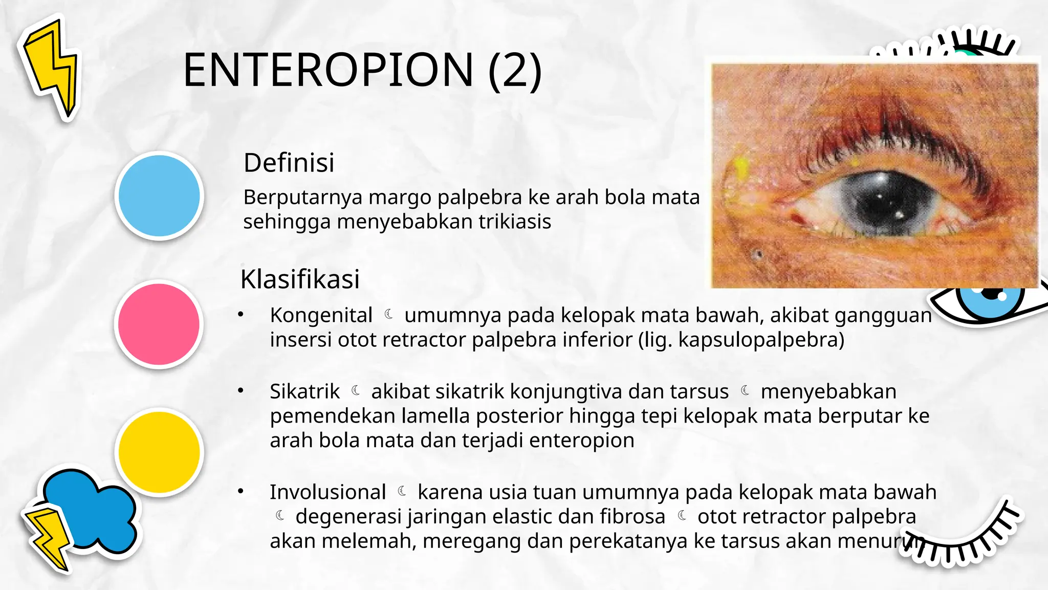 Tentiran PPT Anatomi dan Penyakit Palpebra.pptx