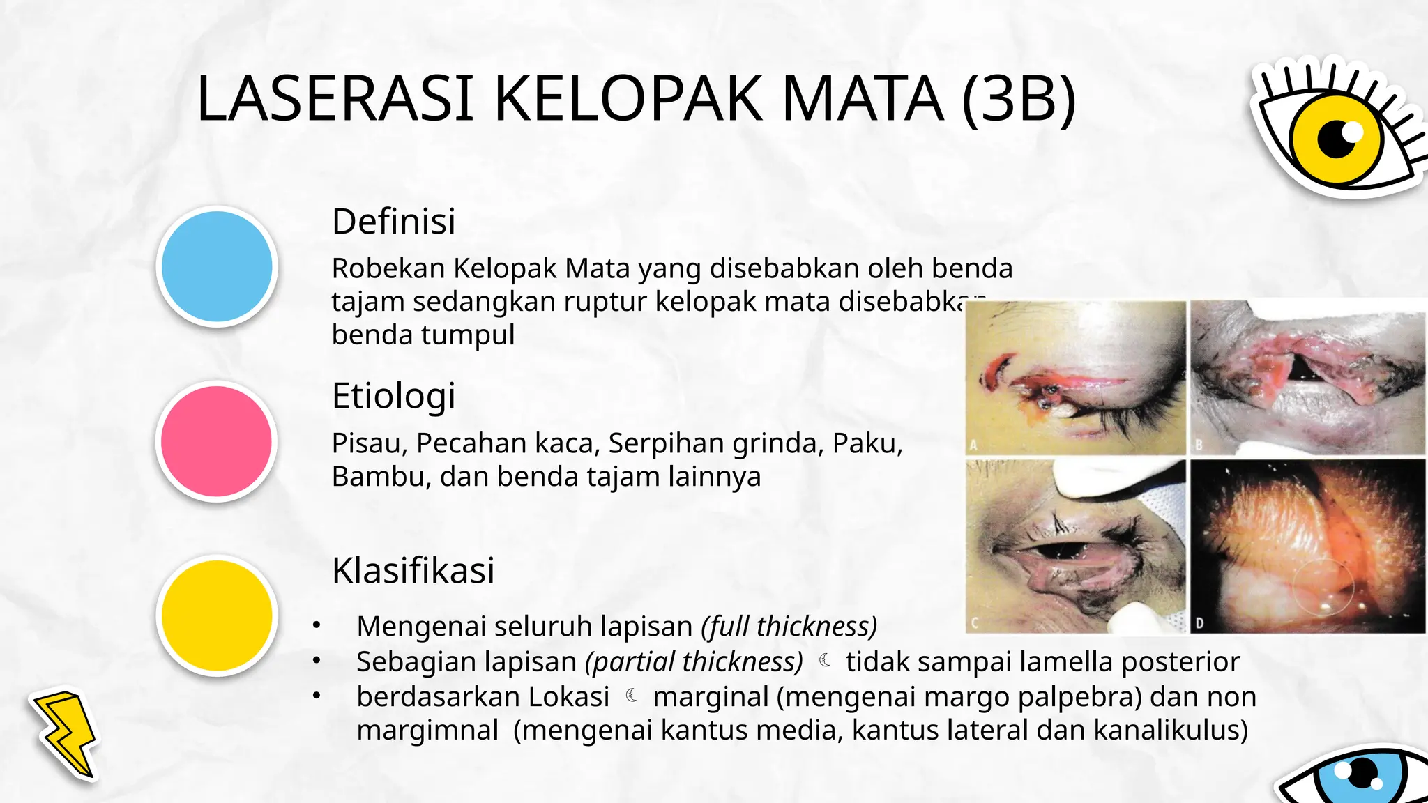 Tentiran PPT Anatomi dan Penyakit Palpebra.pptx