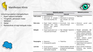 Tentiran PPT Anatomi dan Penyakit Palpebra.pptx