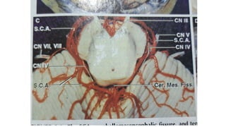 anatomical points about tentorial incisura | PDF