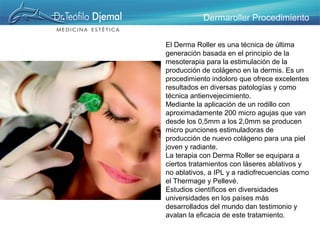 Dermaroller: Teófilo Djemal Medicina Estética | PPT