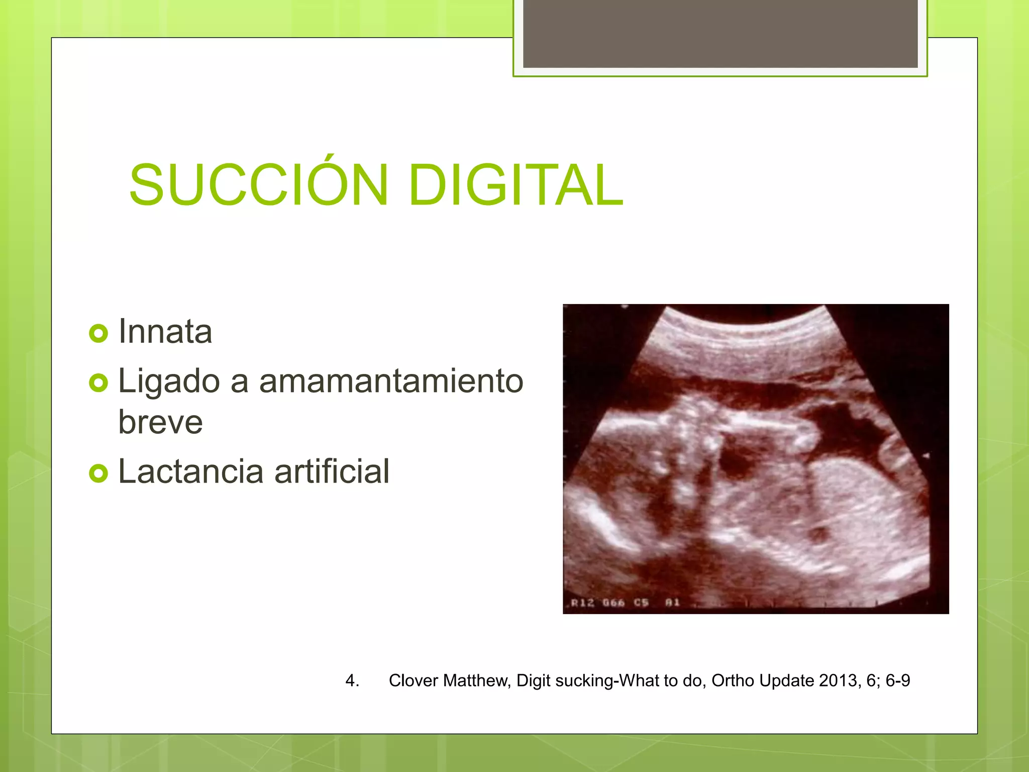 Teorías psicológicas de succión digital | PPTX