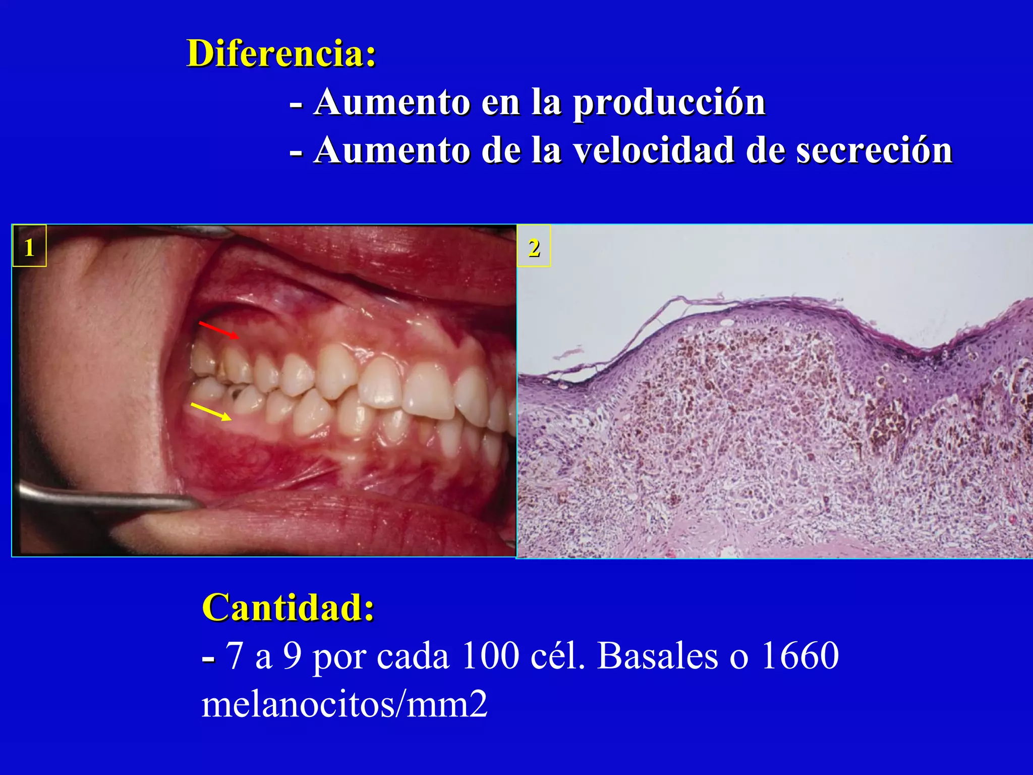 Epitelio Mucosa Oral