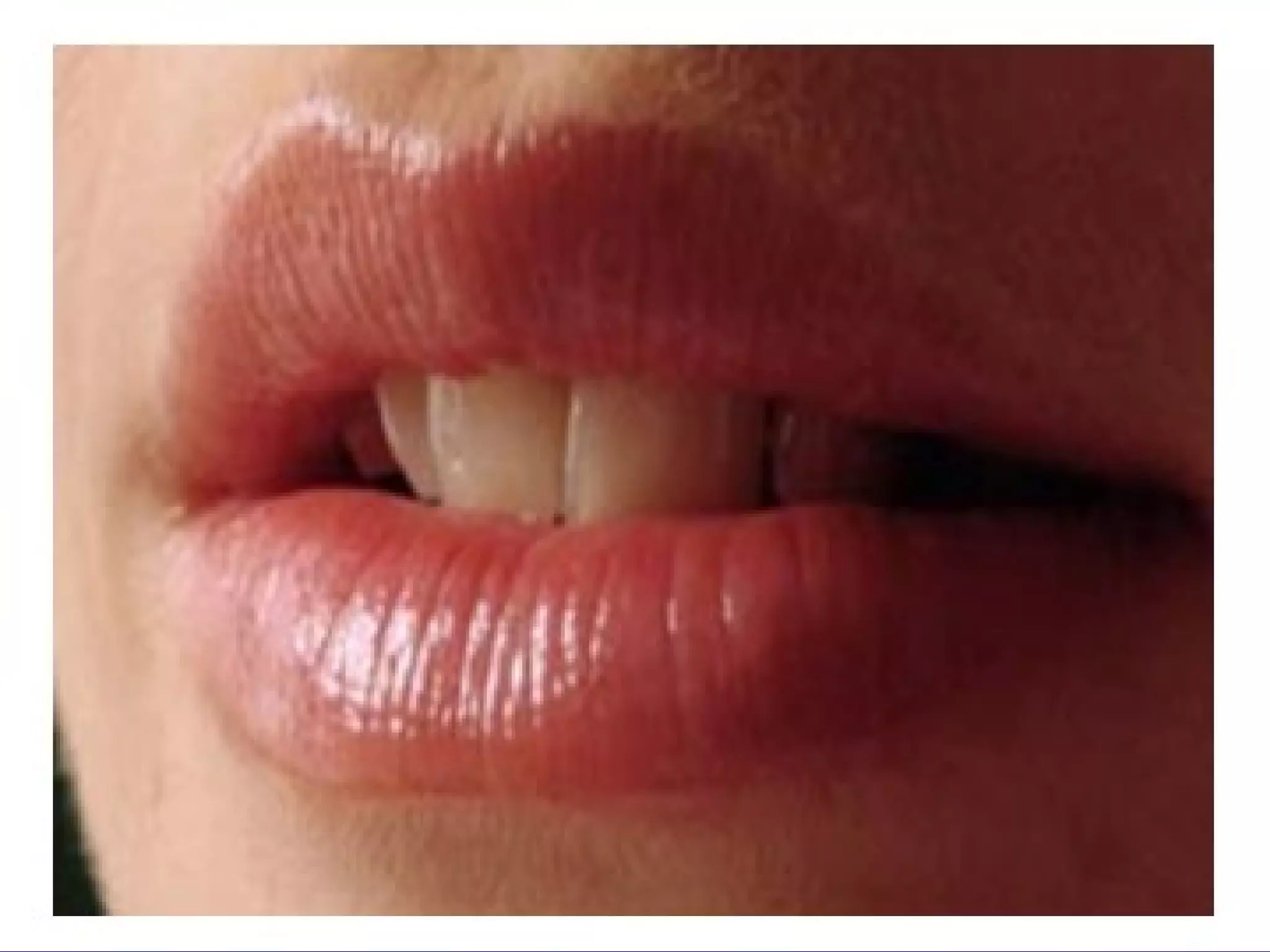 MUSCULOS CUTANEOS DEL CRANEO Y CARA | PPT