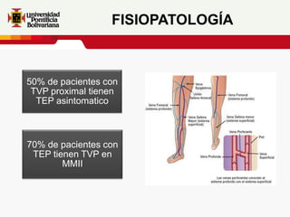 Tromboembolismo pulmonar (TEP) | PPTX