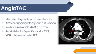 Tromboembolia pulmonar | PDF