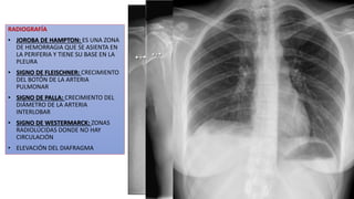 TEP tromboembolismo pulmonar educación médica | PPTX