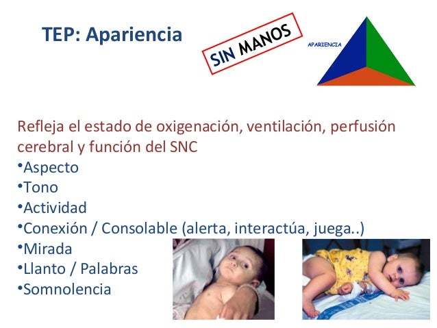 TRIANGULO DE EVALUACIÓN EN PEDIATRIA