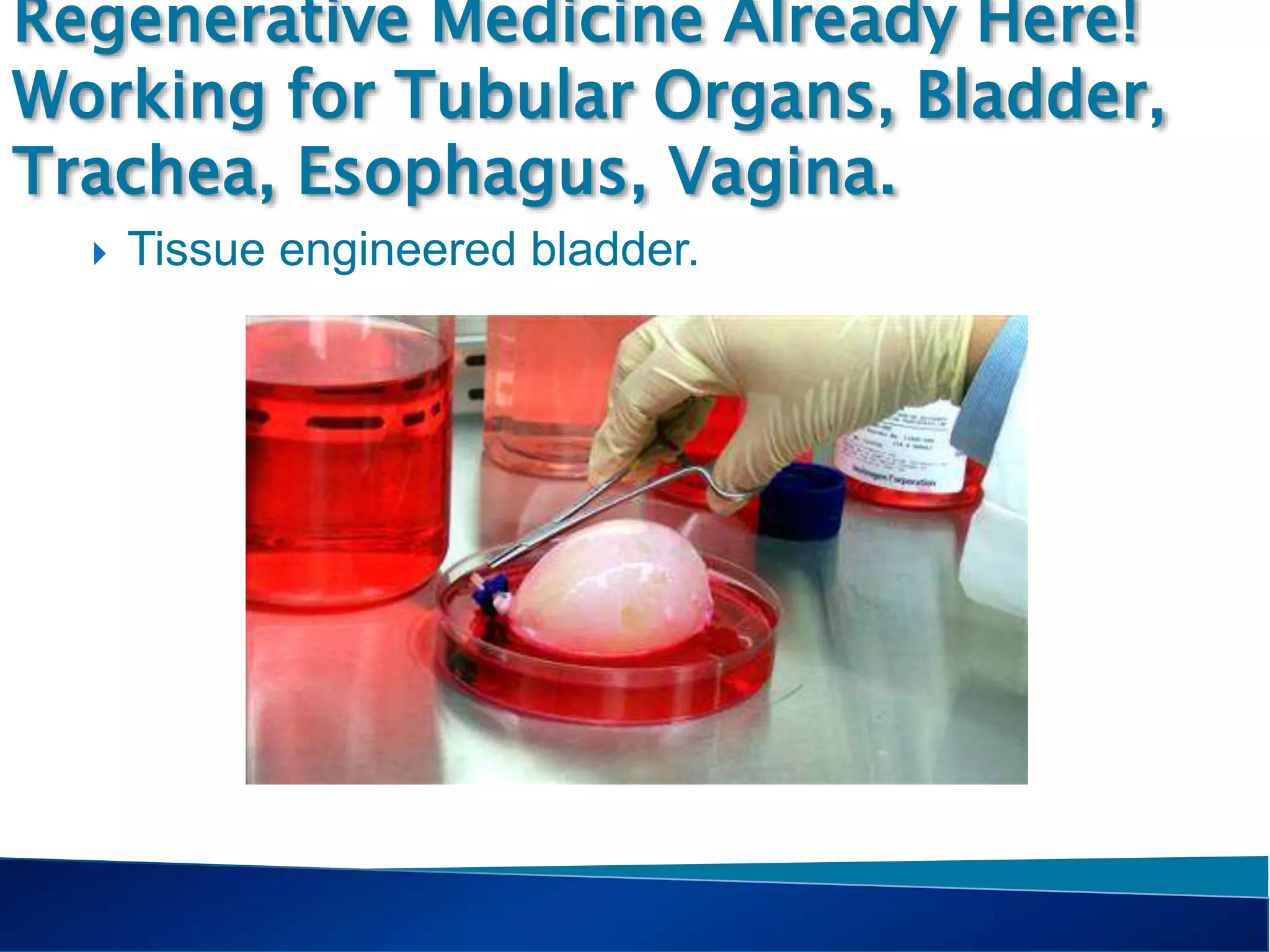 Kim Solez Tissue Engineering Pathology Meets Human Cell Atlas a Glimpse ...