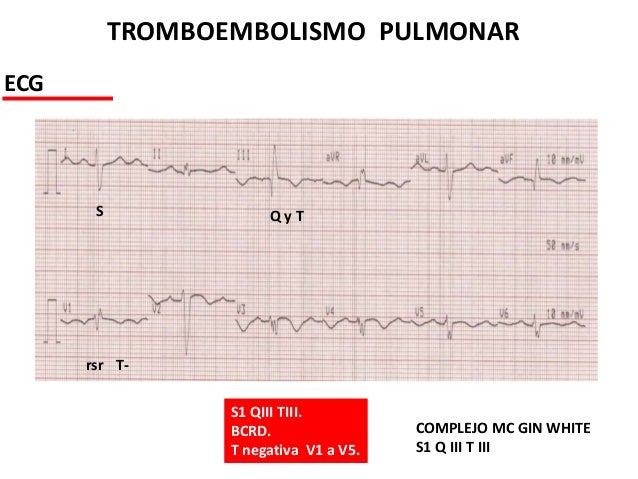 Tep posgrado de emergencia hospital de clinicas