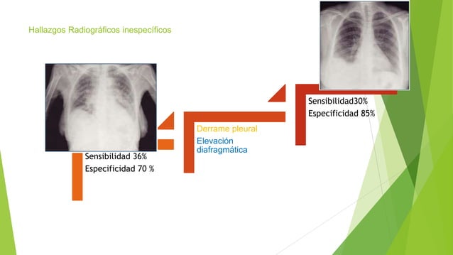 TEP PRESENTACION AGRECACION DE CASCADA DE COAGULACION.pptx