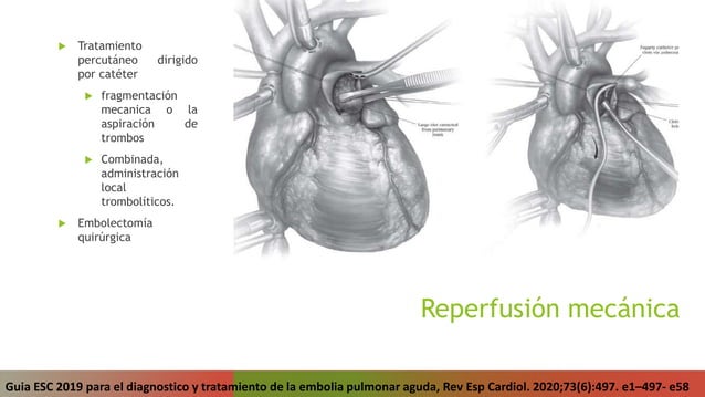 TEP PRESENTACION AGRECACION DE CASCADA DE COAGULACION.pptx