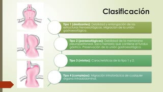 Tera Esofagitis, hernia hiatal, gastritis aguda y crónica, úlcera ...