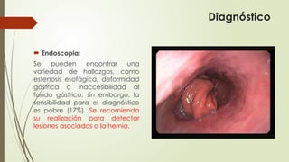 Tera Esofagitis, hernia hiatal, gastritis aguda y crónica, úlcera ...