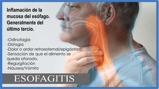 Tera Esofagitis, hernia hiatal, gastritis aguda y crónica, úlcera ...