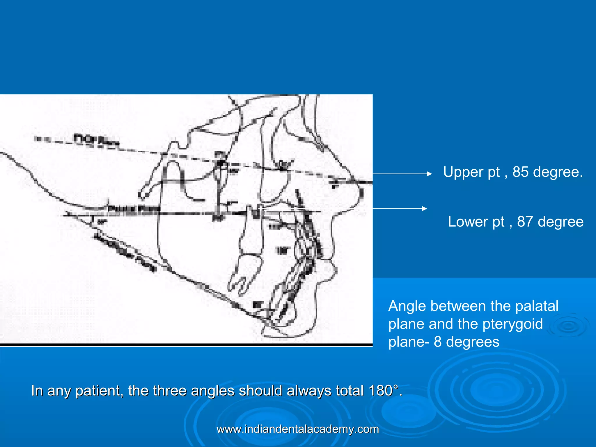 Tetragon a visual cephalometric analysis | PPT