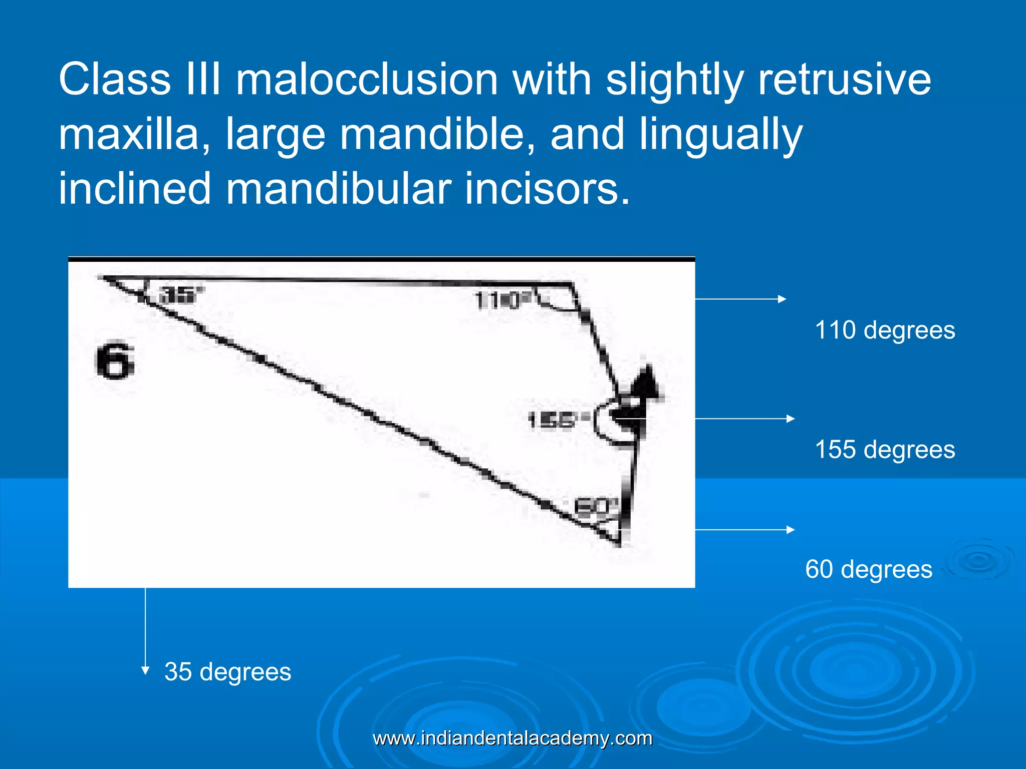 Tetragon a visual cephalometric analysis | PPT