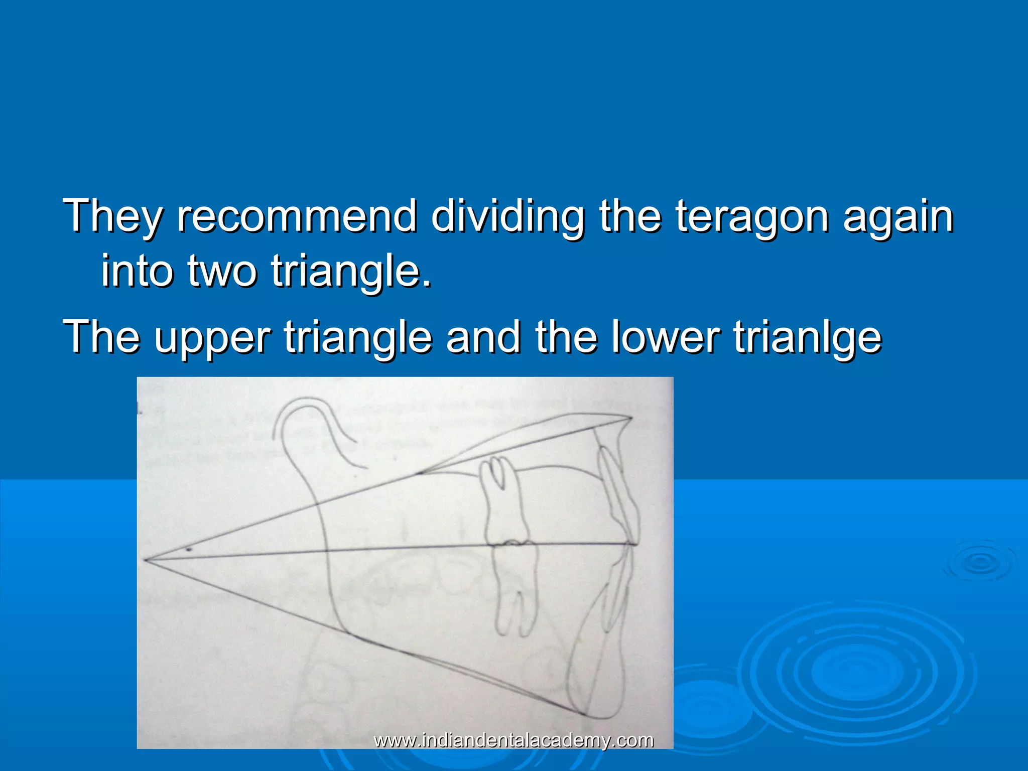 Tetragon a visual cephalometric analysis | PPT