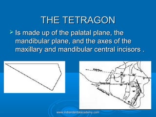 Tetragon a visual cephalometric analysis | PPT