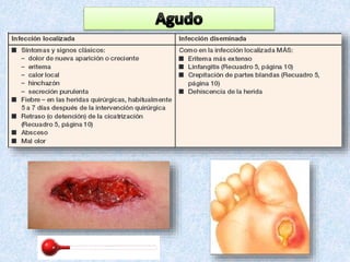 Terapeutica de la herida infectada | PPTX