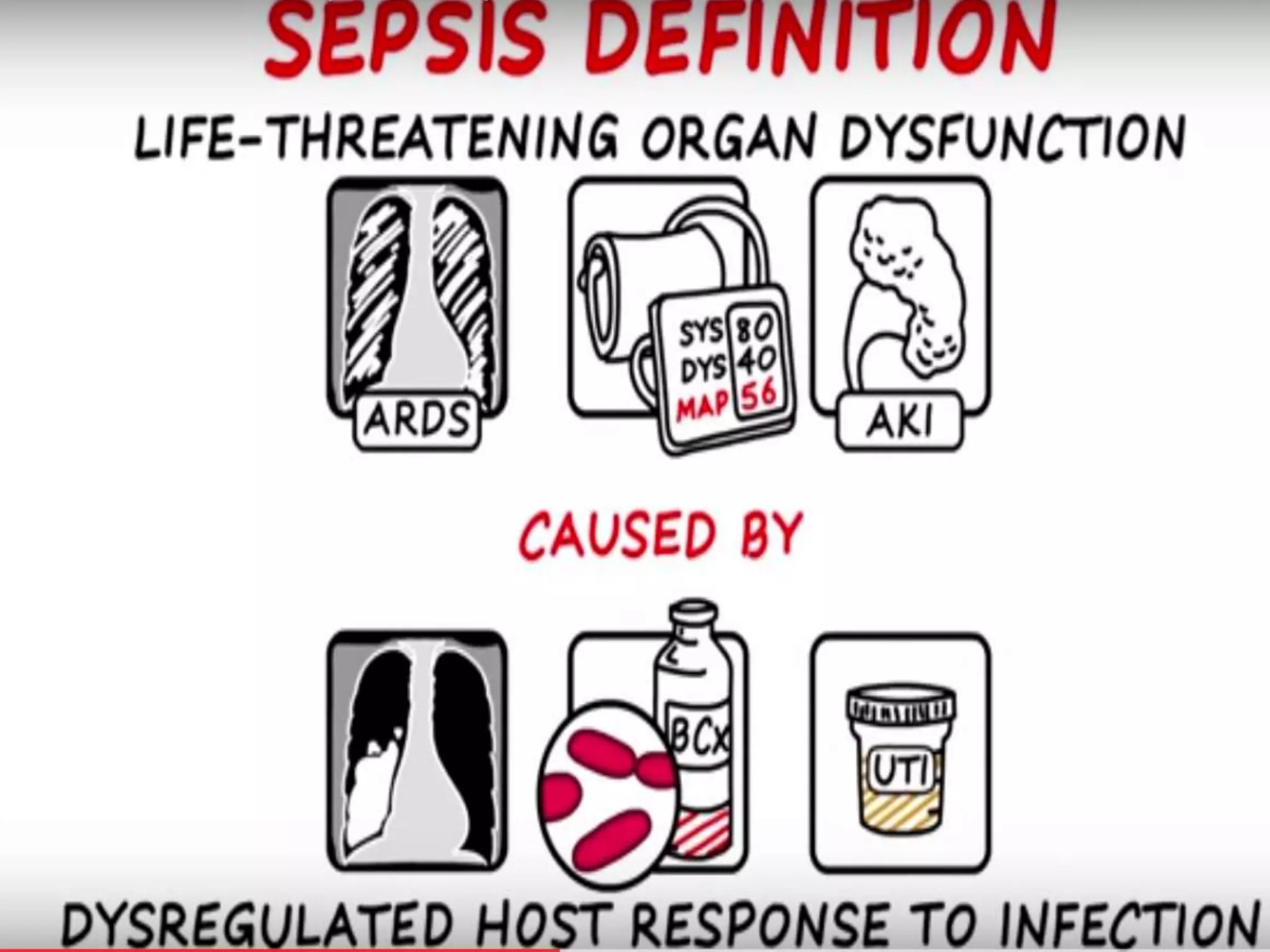 Terapia antimicrobica nella sepsi addominale | PPT