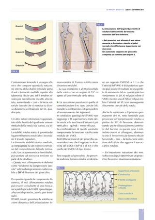 Terapia della condropatia femoro rotulea | PDF