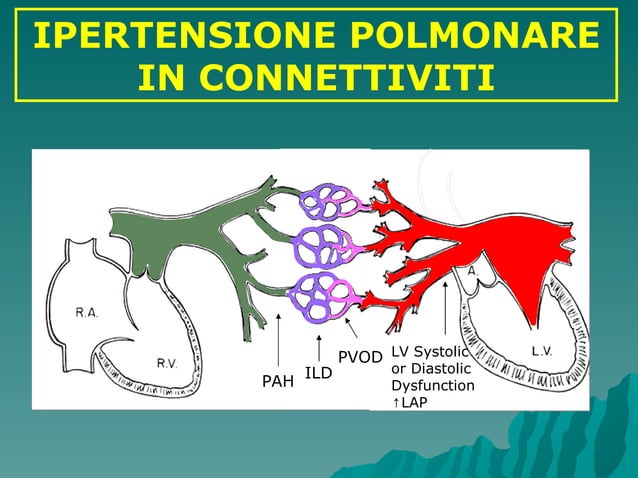 Terapia orale pah | PPT | Medical Health