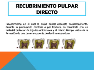 TERAPIA PULPAR EN PACIENTES PEDIATRICOS. | PPTX