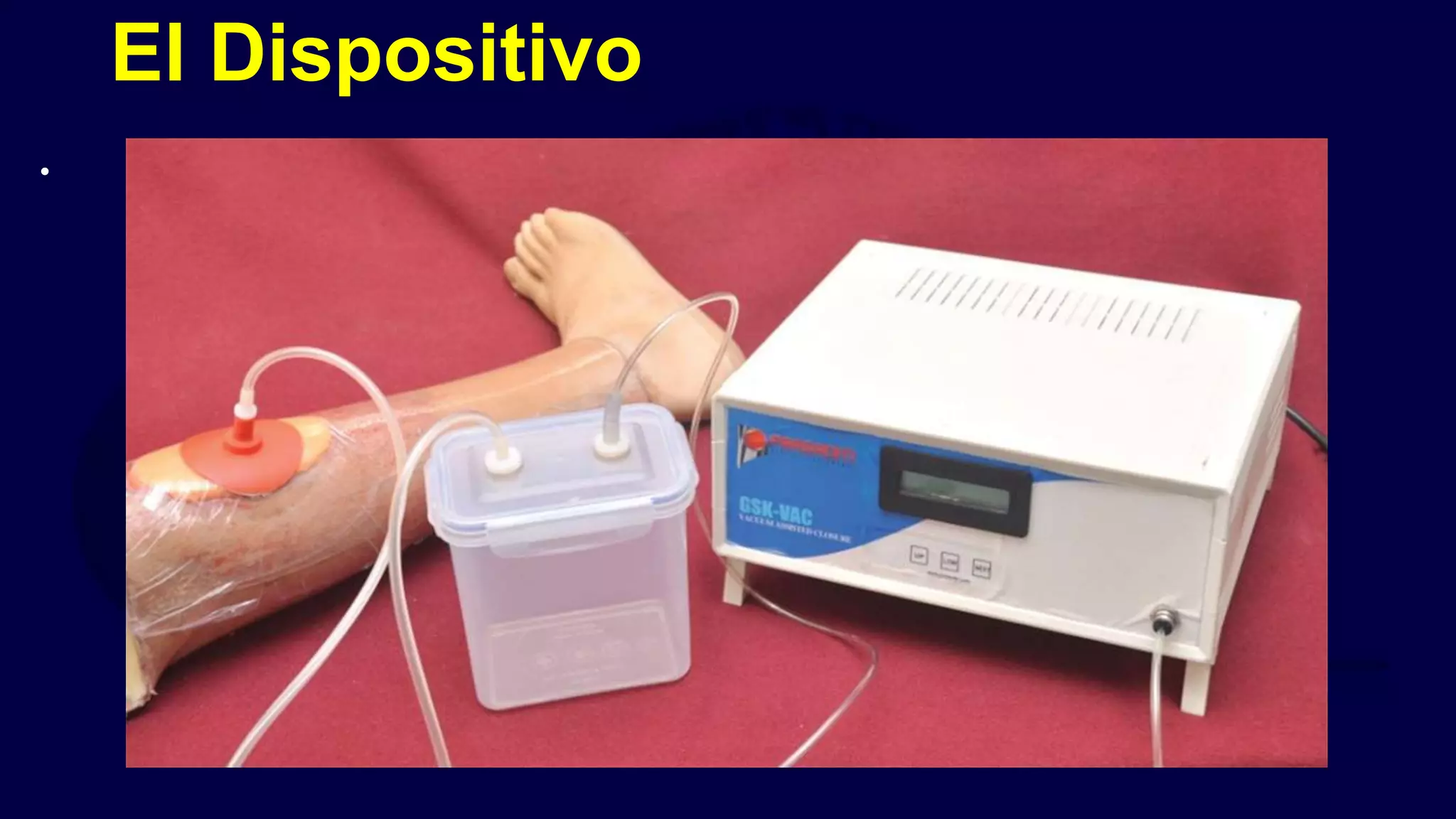 Terapia VAC.pptx