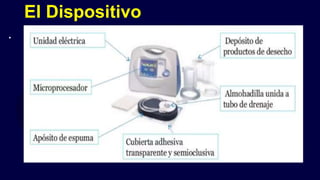 Terapia VAC.pptx