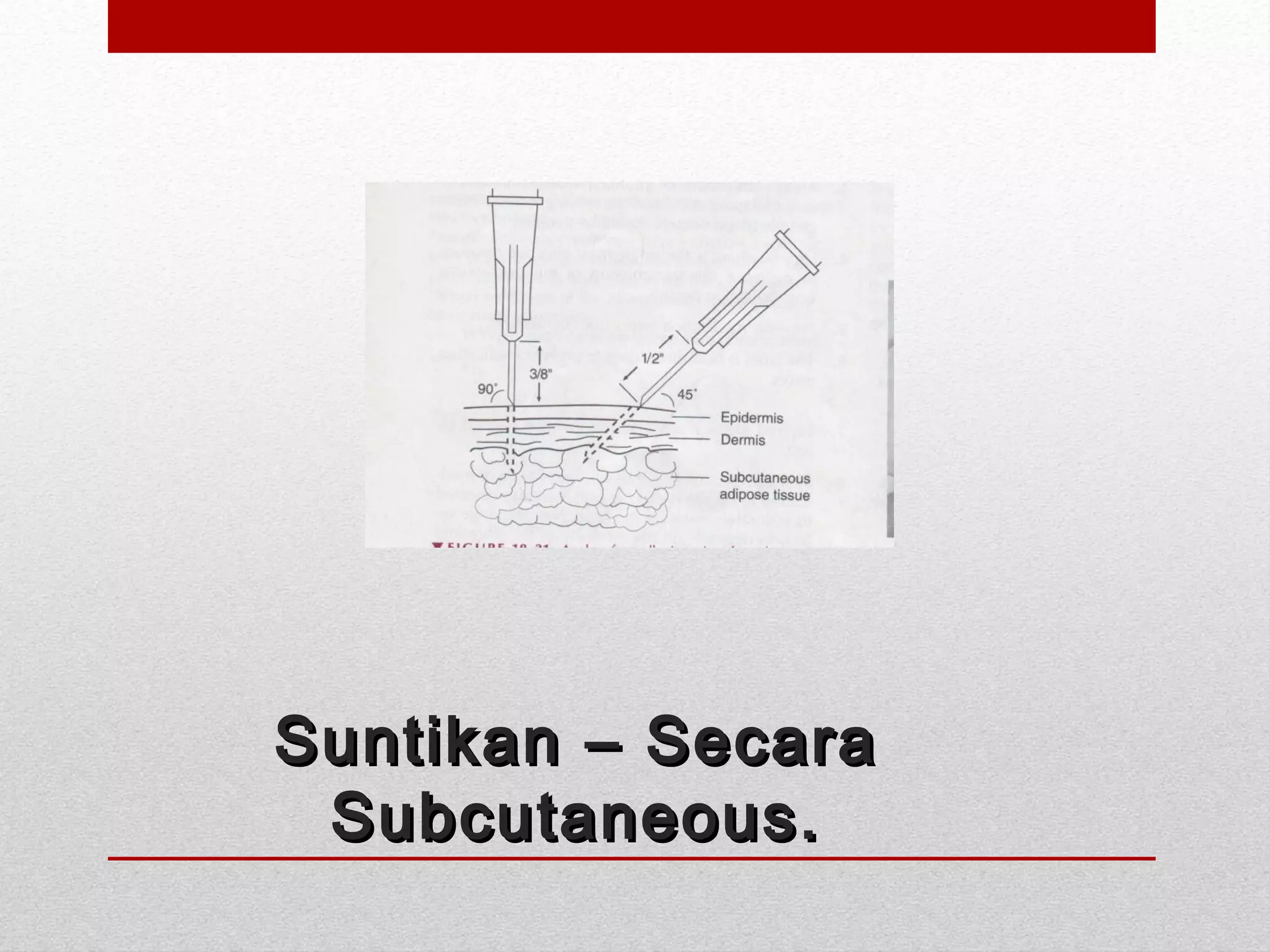 TERAPI INSULIN | PPT