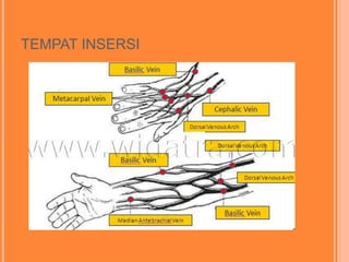 Terapi intravena | PPTX
