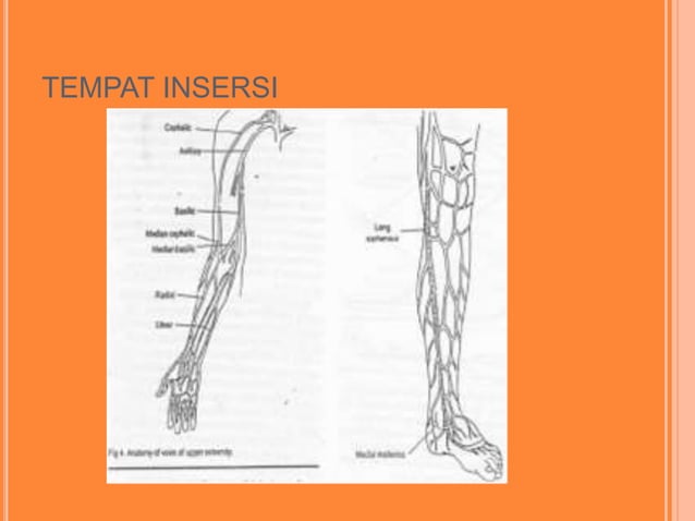 Terapi intravena | PPTX