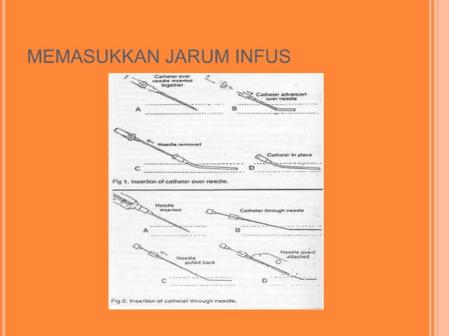 Terapi intravena | PPTX