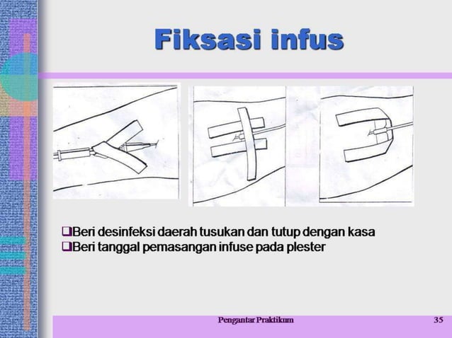 Terapi intravena | PPTX