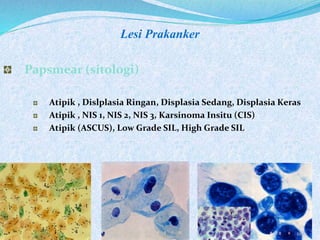Terapi Lesi prakanker (Krioterapi).pptx