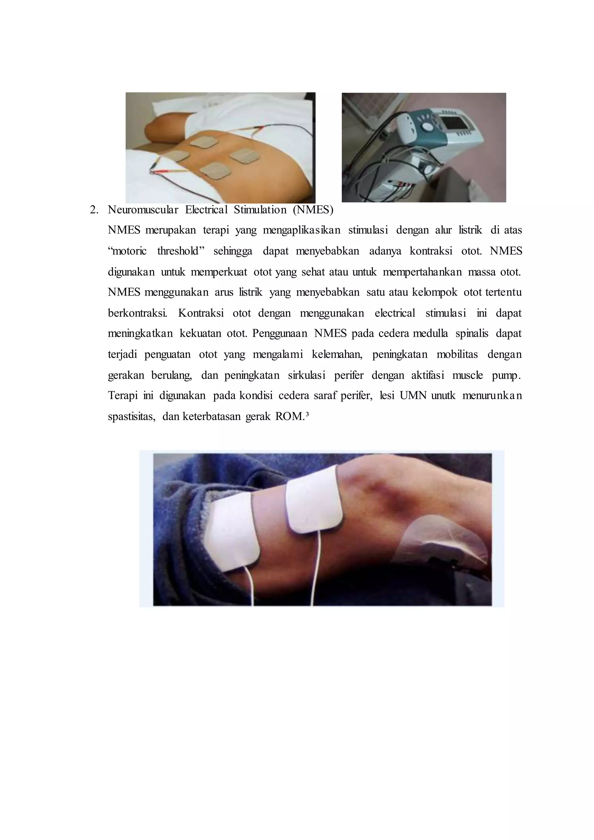 Terapi listrik pada pasien spinal cord injury | PDF