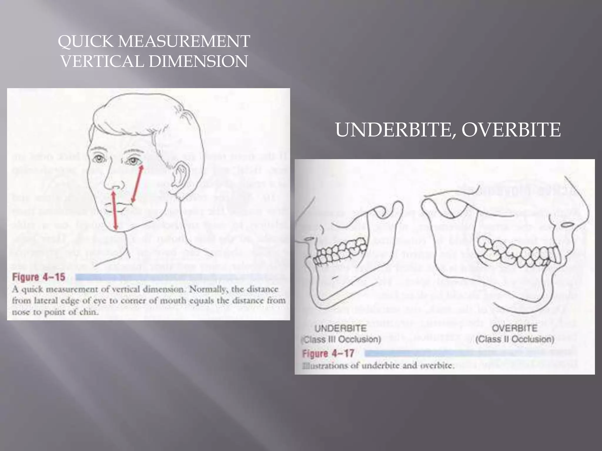 Terapi manual TMJ dalam Fisioterapi | PPTX