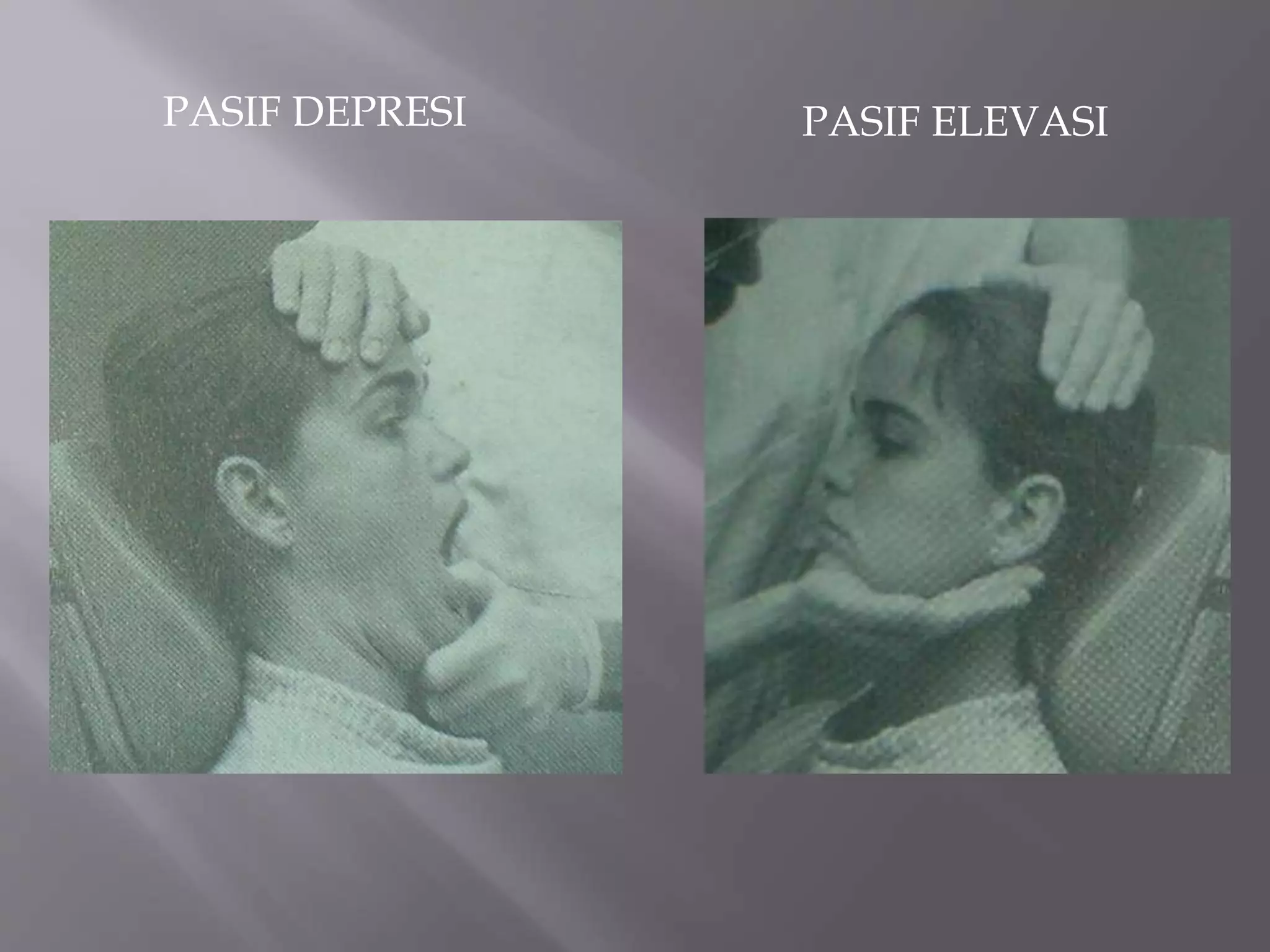 Terapi manual TMJ dalam Fisioterapi | PPTX