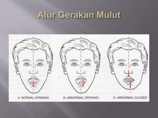 Terapi manual TMJ dalam Fisioterapi | PPTX