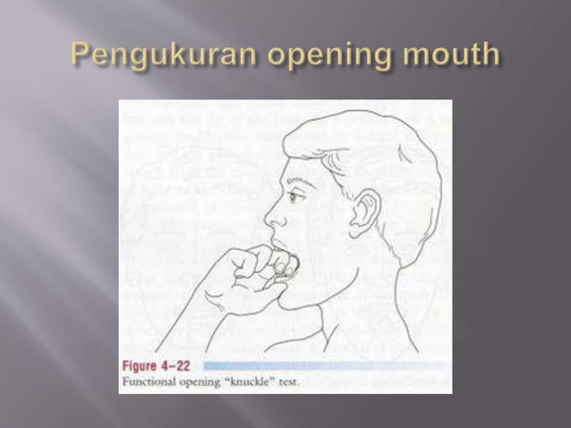 Terapi manual TMJ dalam Fisioterapi | PPTX