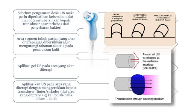 Terapi Ultrasound III.pptx