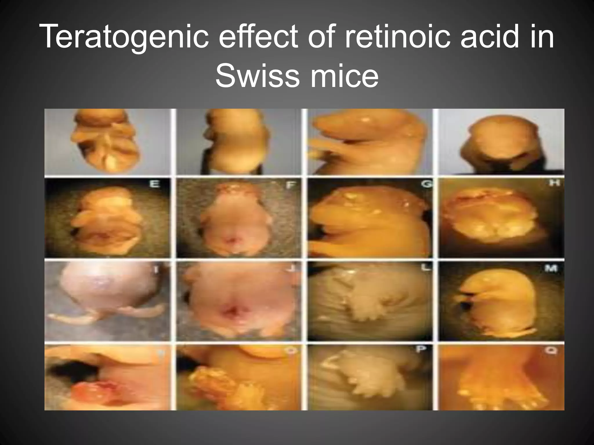 Teratogenesis | PPTX