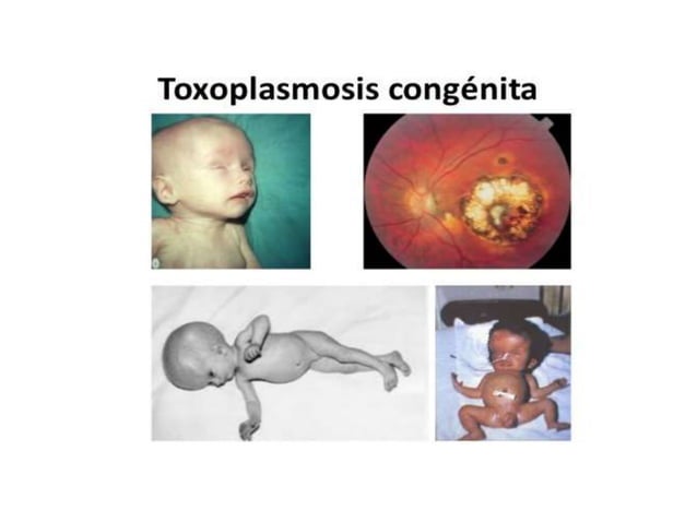 Teratogenesis (causing of congenital abnomalies) | PPT