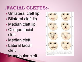 Teratogens And Cleft Types | PPTX